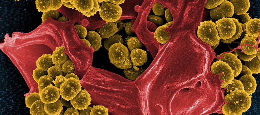 Bacteria overcome hurdles to jump between species | Edinburgh ...