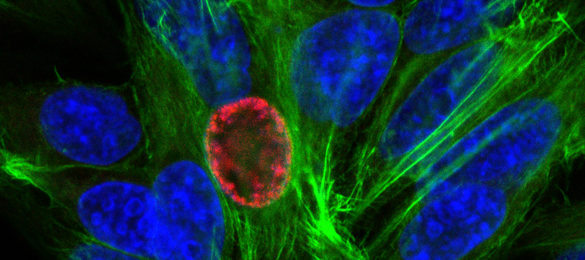 Developing novel therapeutics for infection and inflammation - Peter ...